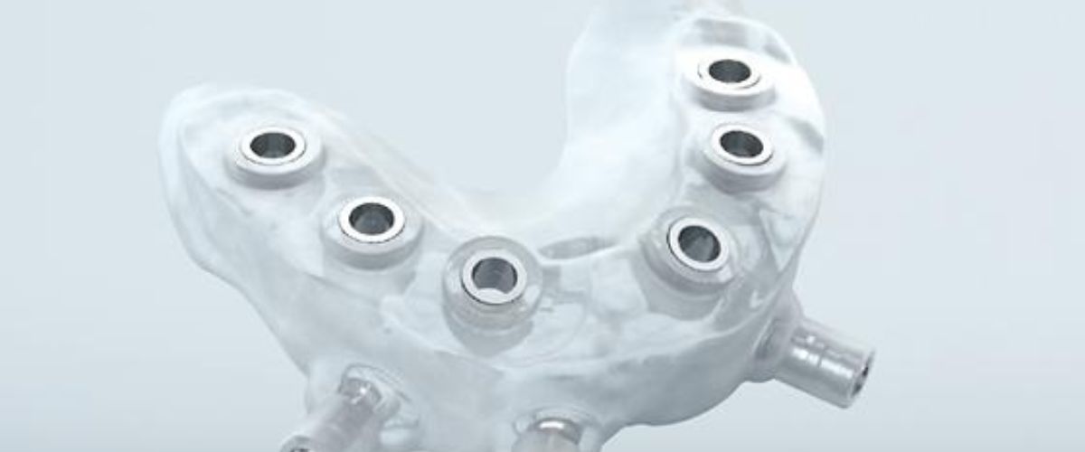 PLANEACION DE IMPLANTES Y GUIA DE 3 O MAS IMPLANTES